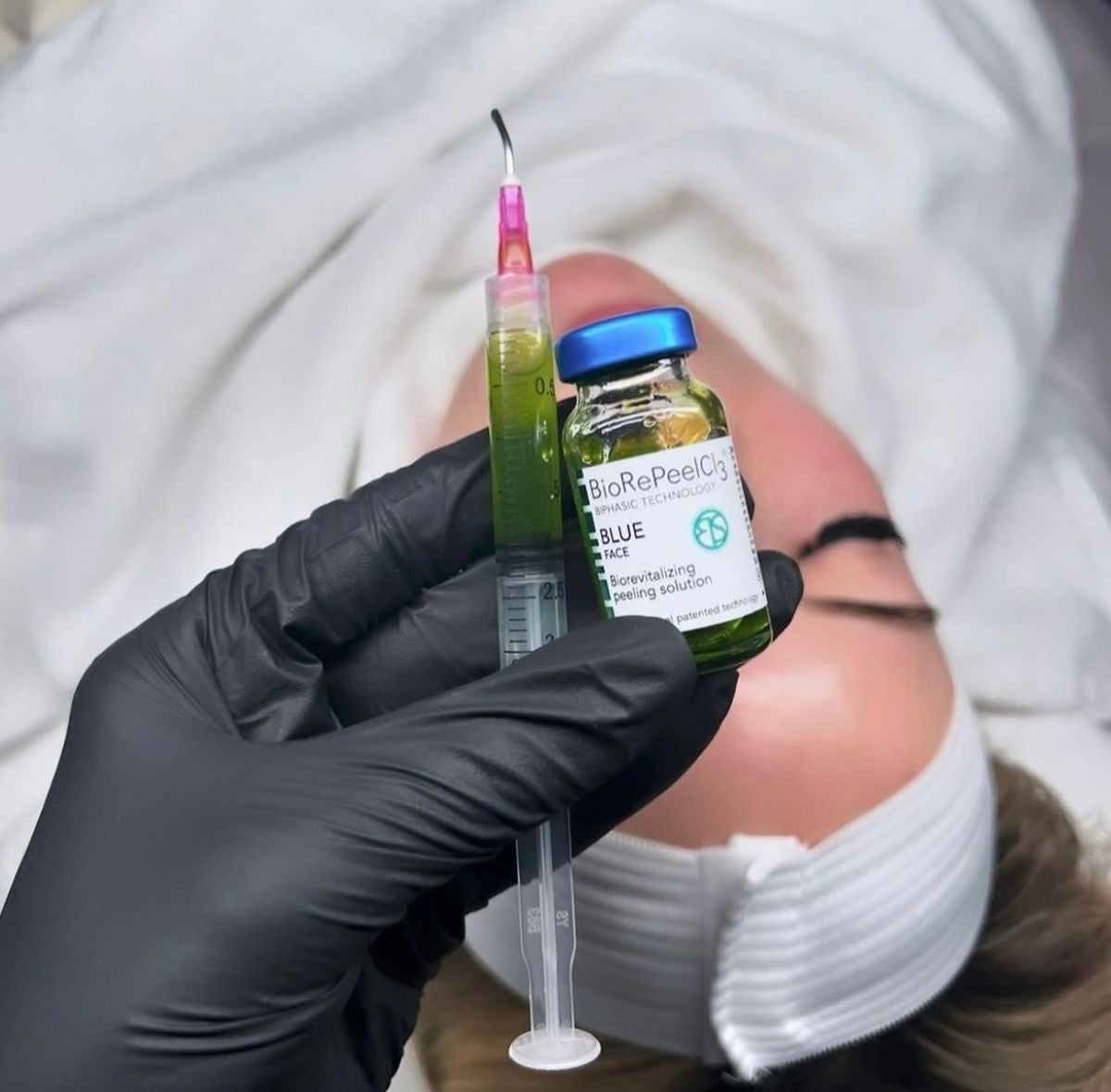 BioRePeel – Skin Boss Dermal Aesthetics